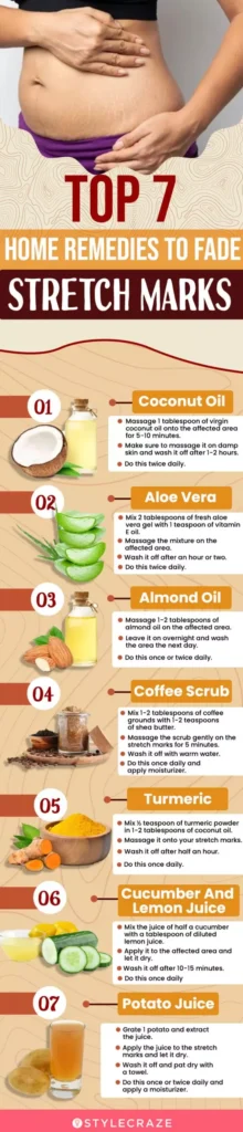 Natural Remedies Against Stretch Marks - Edition Time