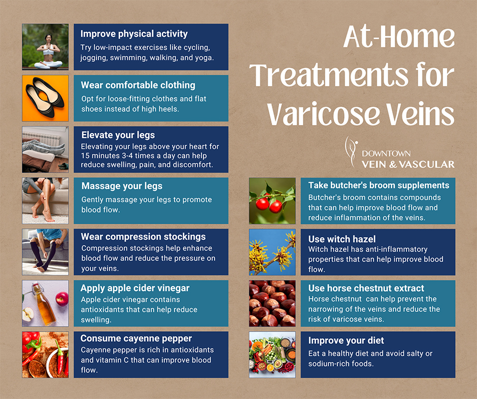 Natural Remedies Against Varicose Veins - Edition Time